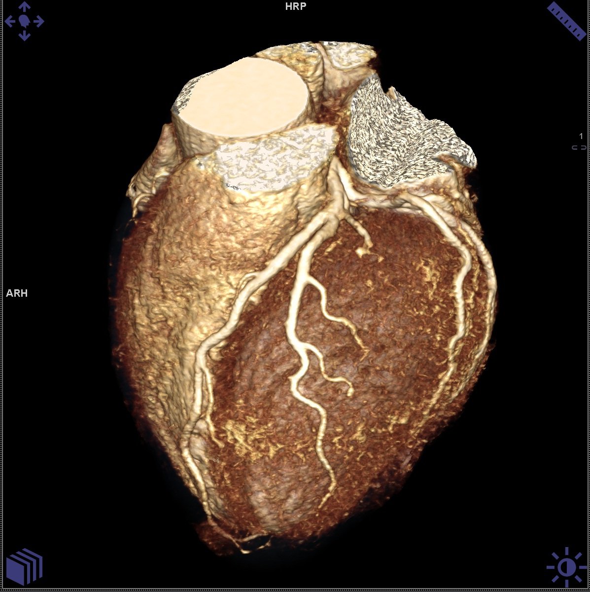 Scanner pour localiser les lésions ou avant intervention à Osny