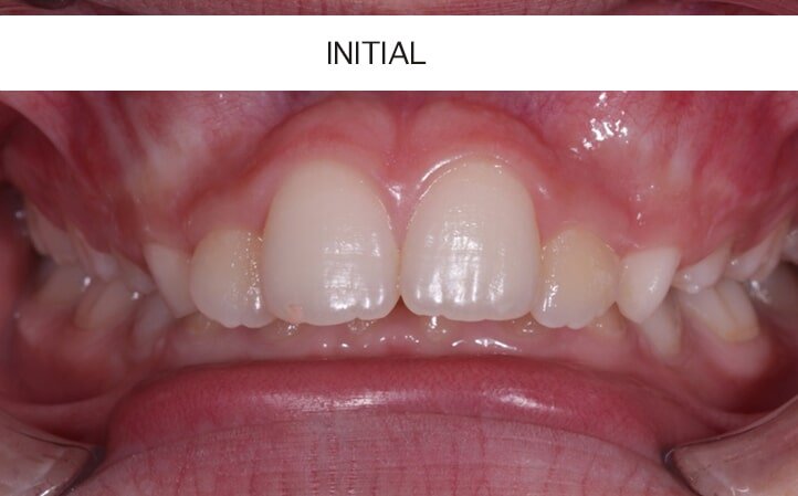 Functional Jaw Orthopedics | Malo Clinic