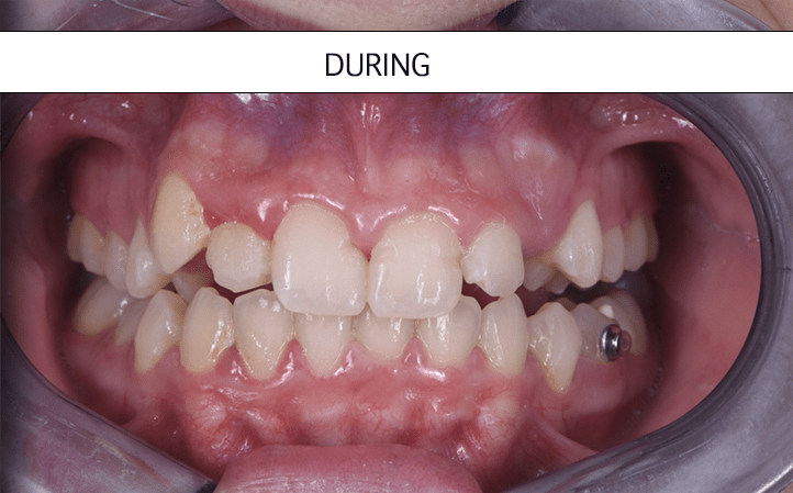 Functional Jaw Orthopedics | Malo Clinic