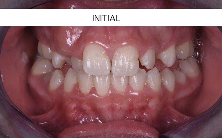 Functional Jaw Orthopedics | Malo Clinic