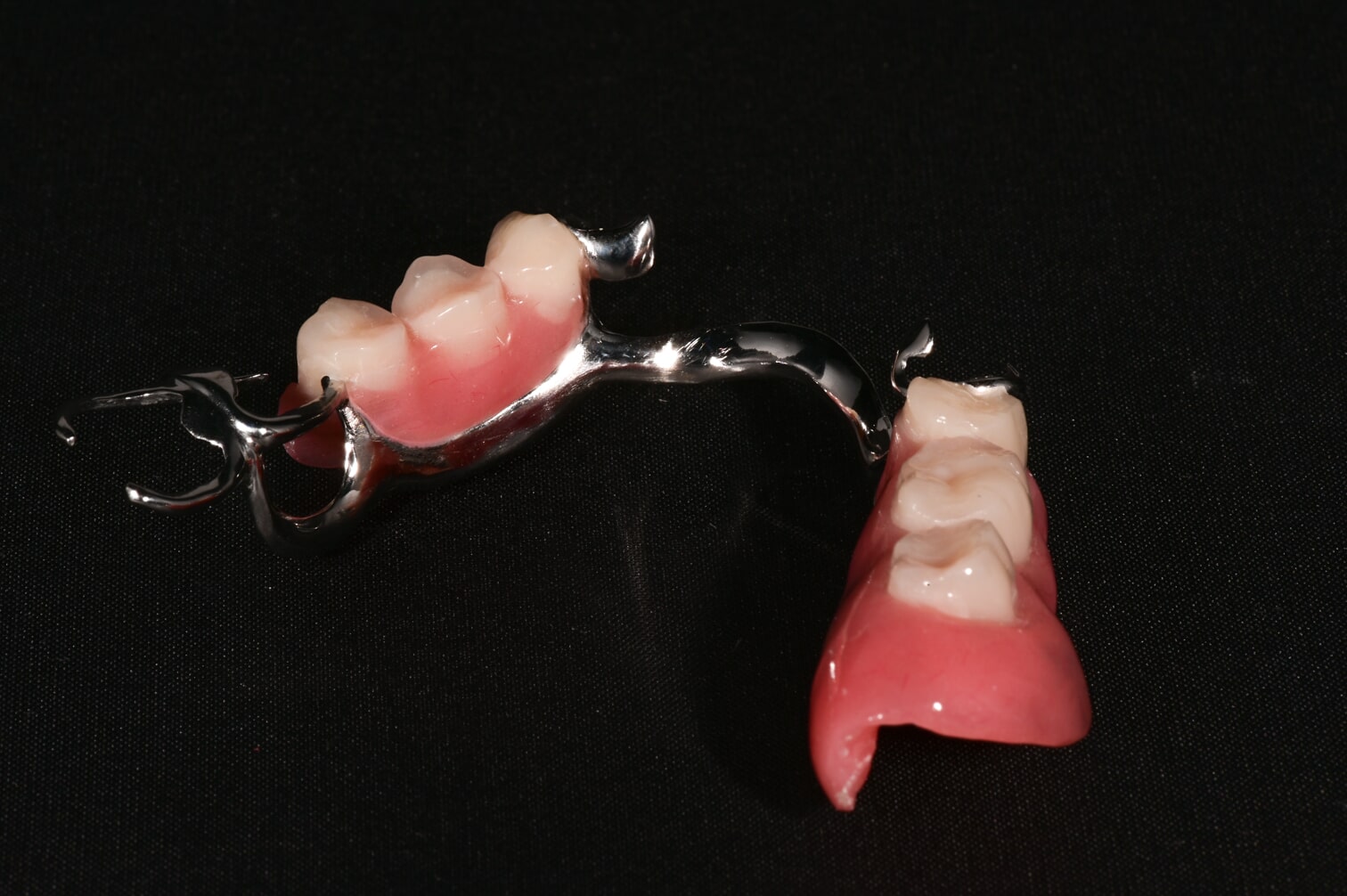 Próteses Fixas - Próteses Removíveis | Trabalhos sobre Implantes