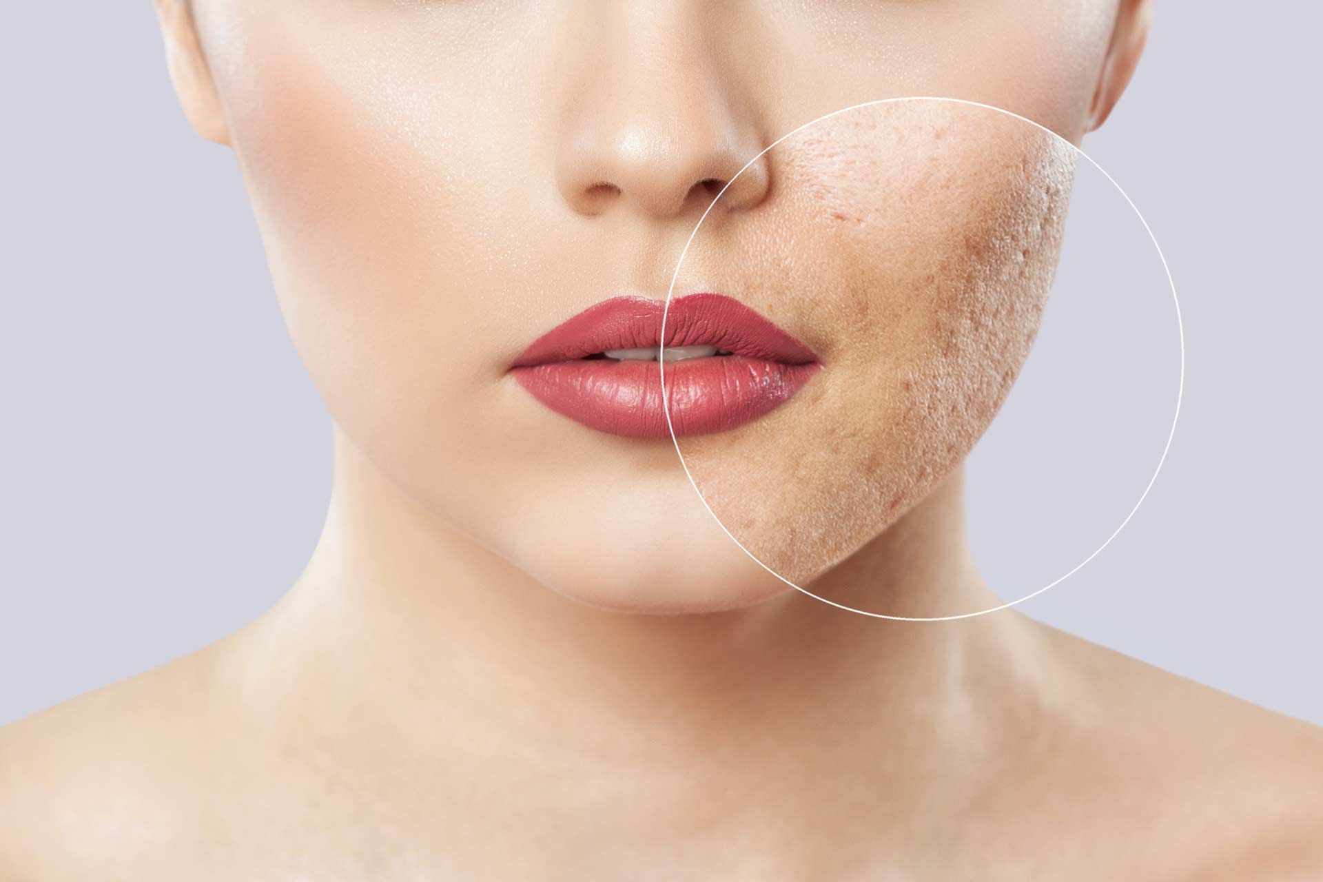 Cliderm - Cabinet de dermatologie à Bruxelles