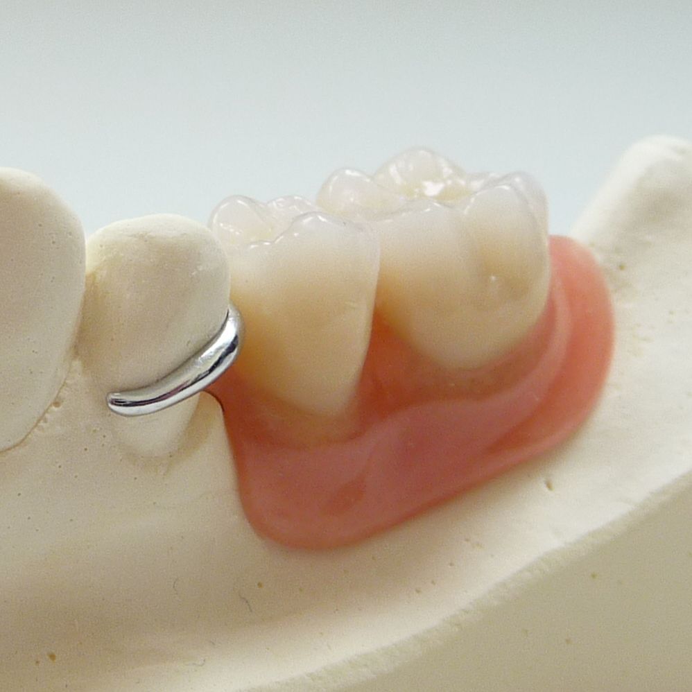 Laboratoire dentaire Chantal Clerc - Prothèses amovibles-stellites