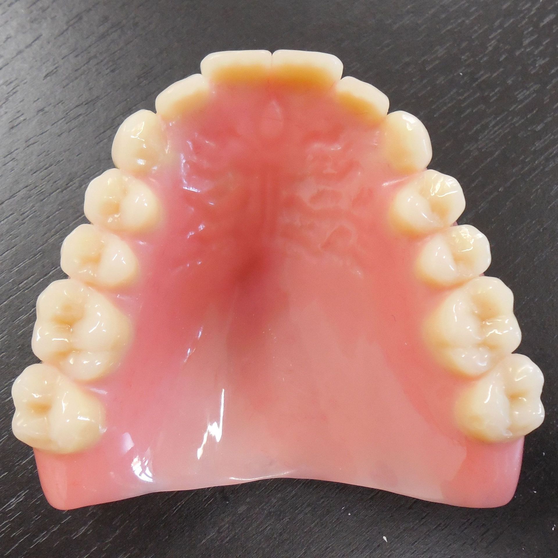 Laboratoire dentaire Chantal Clerc - Réalisation d'une prothèse