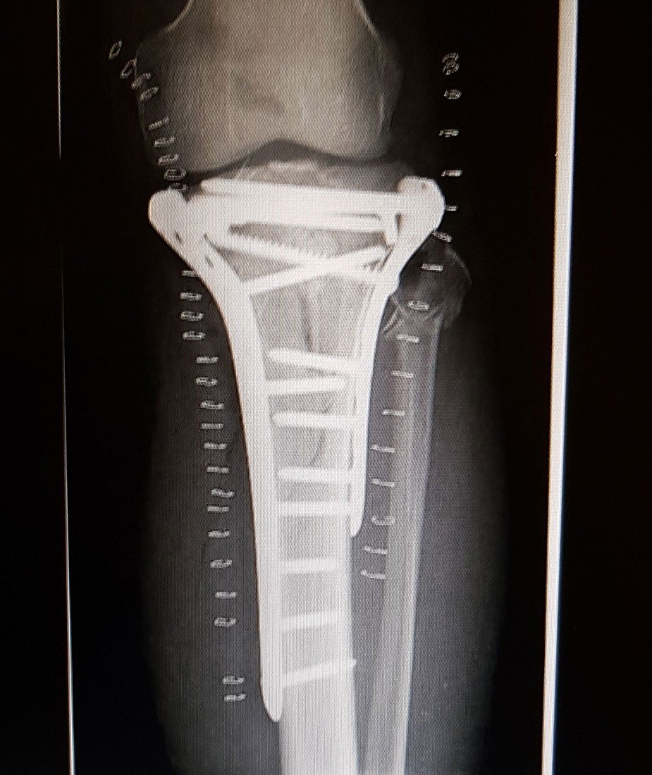 Pathologie du Genou à traiter dans notre clinique à Paris